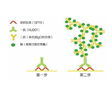 肿瘤特异性蛋白70抗体试剂（免疫组织化学法）--科德